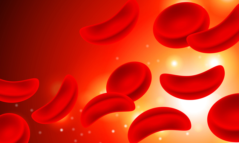 It’s time to pay attention to sickle cell disease