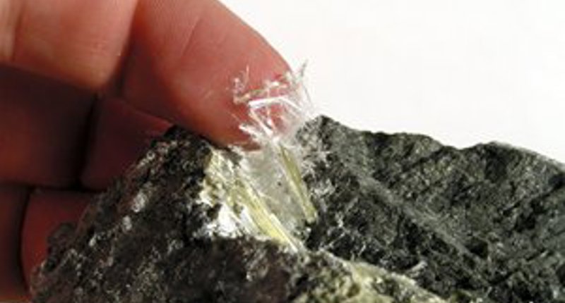 Uralite worker develops pleural thickening from asbestos